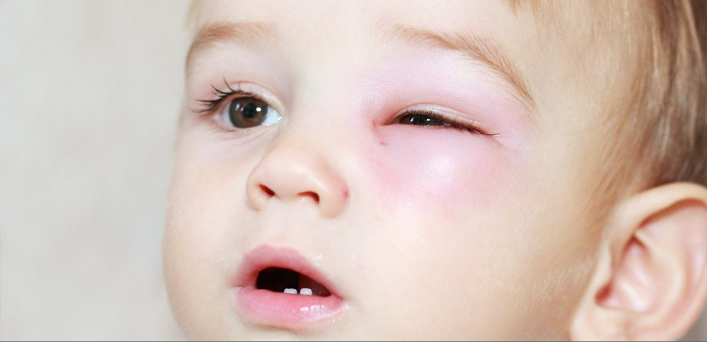 El niño de 3 años y 8 meses